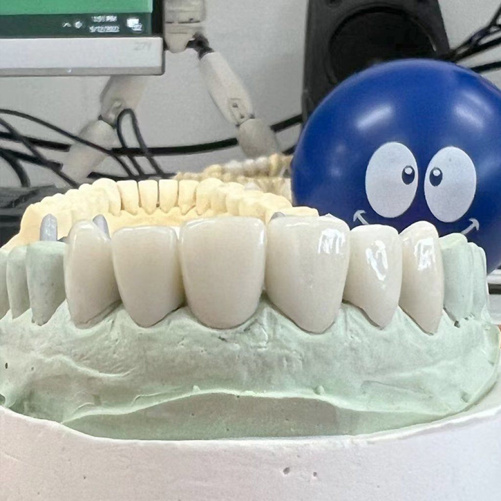 IFUN Temporary Crown Resin A1 (iF3164) 0.5KG - Lancer3D-3D Printer Egypt Store